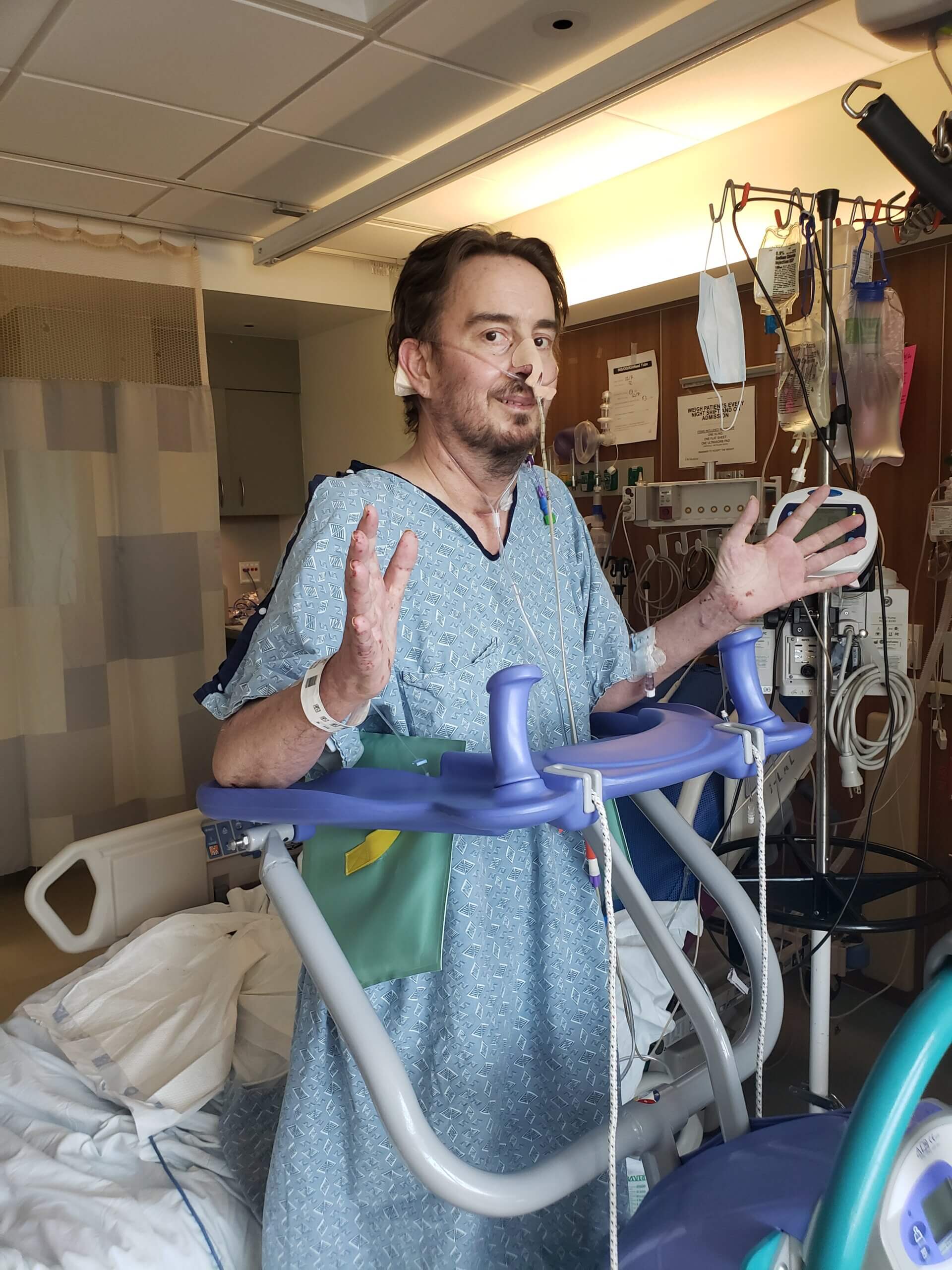 Meet Jim Valley, showman, survivor and inspiration | Northwest Kidney ...